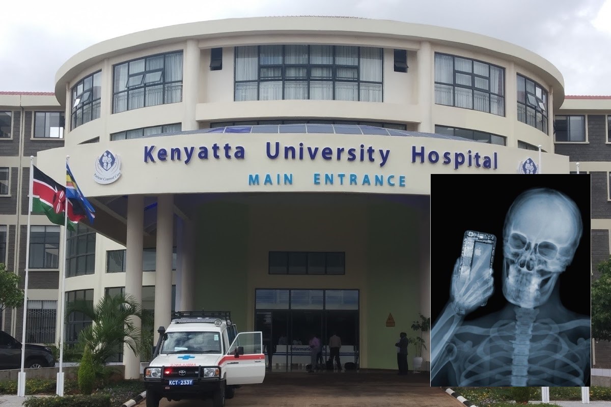 KU Hospital Bans use of X-Ray Machines to Take Selfies - PostaMate